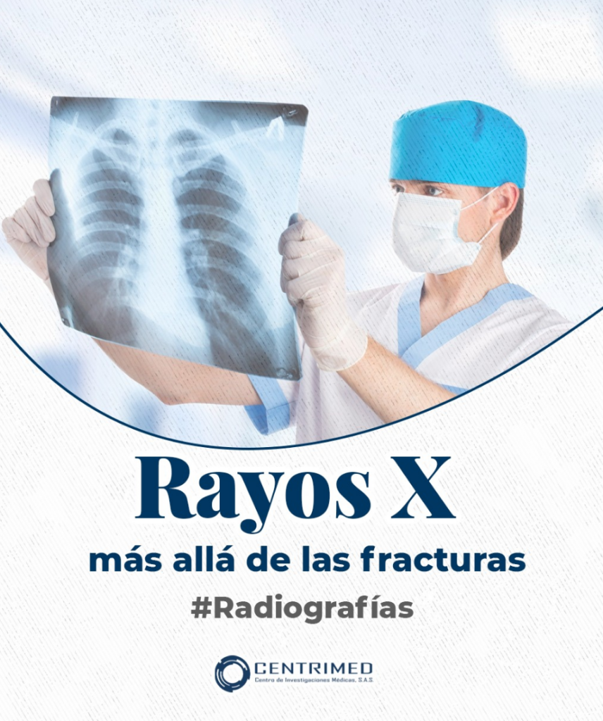 Rayos X – CENTRIMED